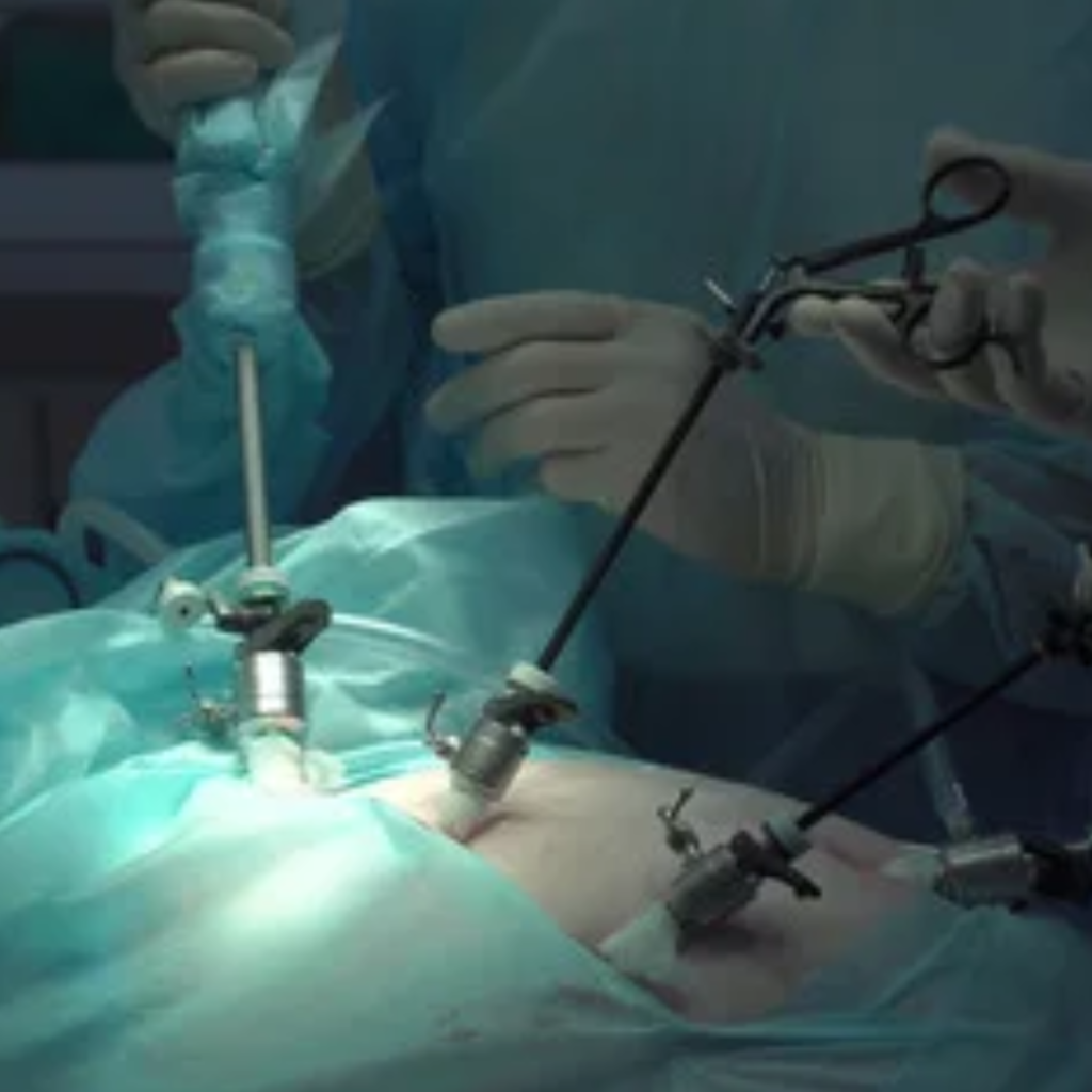 General & Laparoscopic Surgery - Best Multispecialty Hospital in Mulund
